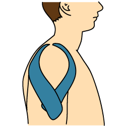 How To Tape Injuries